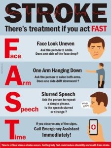 Act FAST for Stroke | Safety Poster Shop
